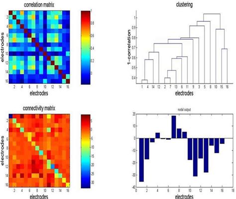Functional Connectivity In Intracranial Eeg Predicts Surgical Outcome