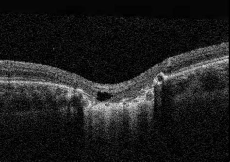 Chrpe Oct Dr Adrián Hernández Martínez