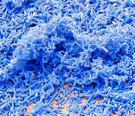 Pseudomonas Bacteria Sem Stock Image C0381165 Science Photo Library