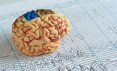 Researchers Discover A Neural Biomarker For Ocd Emj