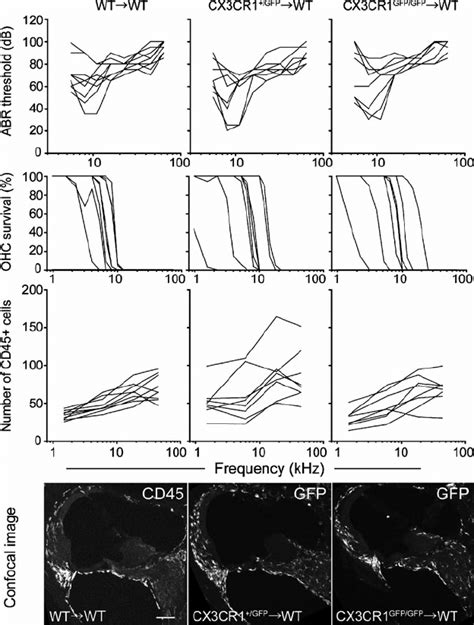 auditory brainstem response abr thresholds cochlear macrophage
