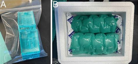 Shipment Of Fixed U54 Specimens Tissue Ffpe All Ovarian Tissue Download Scientific Diagram