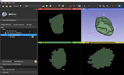 how to open multi frame dicom usage and issues image sc forum