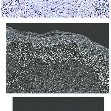 A C Color Deconvolution To Seperate The Hematoxylin Stained Nuclei Download Scientific Diagram