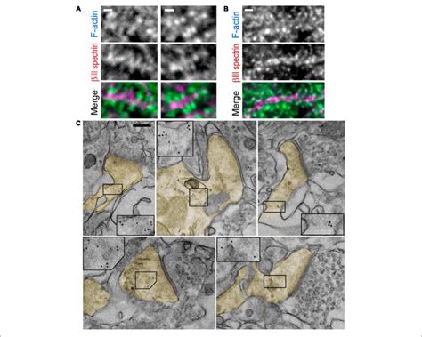 Immunogold Labeling A B Fluorescence Staining With βiii Spectrin Download Scientific