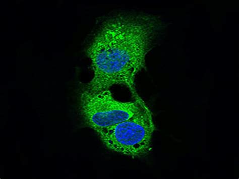 小鼠抗plin2单克隆抗体anti Plin2 Mouse Monoclonal Antibody 生命科学产品与技术服务 生工生物工程