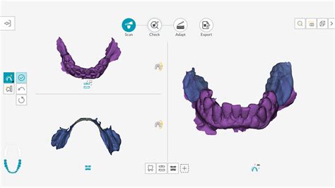 Dexis Intra Oral Scanners With Scan Workflow For Dentures