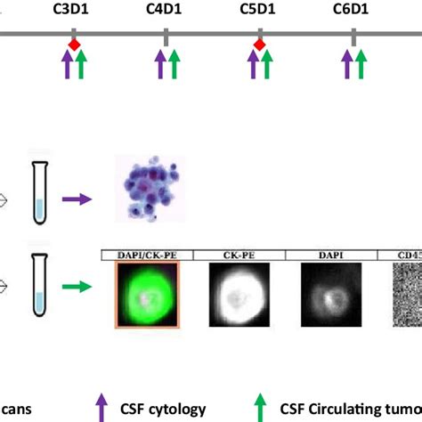 Schema Of The Csf And Mri Assessment And Csf Tests Workflow Indicating