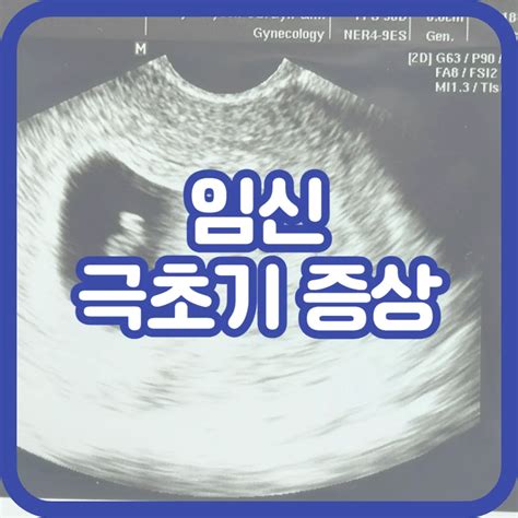 임신 극초기 증상 1주 2주 3주 4주 5주 시기별 증상 언제부터 변비 두통 분비물 착상혈 설사 웰빙 꿀단지