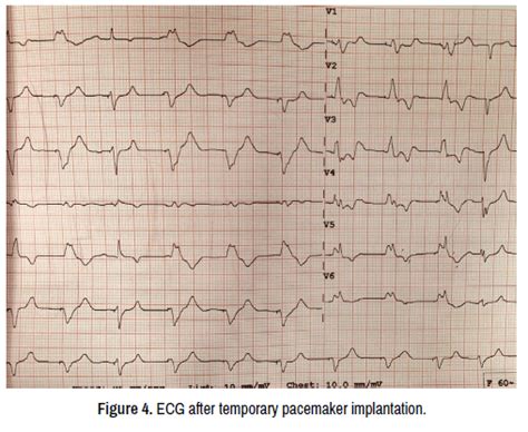Clinical Case Reports Implantation
