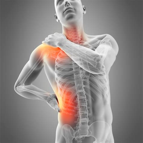 Trigger Point Injections COASTAL MD INTEGRATIVE HEALTH WELLNESS