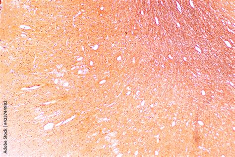 Education Spinal Cord Nerve Cerebellum Cortex And Motor Neuron Human