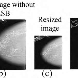 Creating The Edge Map Of A Mammography Image Download Scientific Diagram