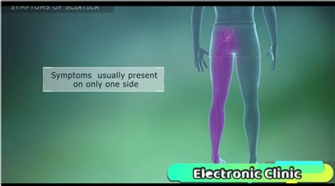 Human Posture Monitoring Using Flex Sensor And Arduino Biomedical Project
