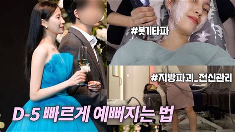 결혼 전 일주일만에 얼굴 붓기 싹 빼는 법⁉️ 급하게 예뻐지는 관리들 싹 모아왔습니다관리의날 예비신부 일상vlog 얼굴 붓기 시술 전신 지방관리 속눈썹 필수관리