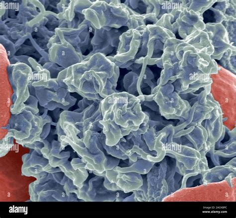 Platelets Coloured Scanning Electron Micrograph Sem Of A Clump Of Activated Platelets From A