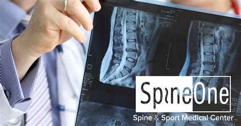Selective Nerve Root Blocks For Pain Management