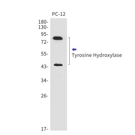 Tyrosine 3 Monooxygenase Recombinant Rabbit Mab Assayvector