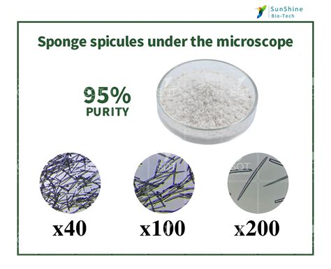 Spongilla Under Microscope