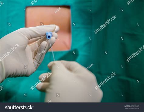 Epidural Analgesiaepidural Nerve Block Foto Stock 670247887 Shutterstock
