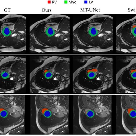 Visualization Of Segmentation Results On The Synapse Dataset Our