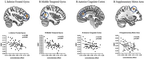 Negative Correlations Between The Individual Concreteness Effect And Download Scientific
