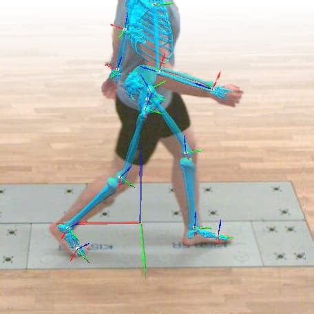 Motion Capture Gait Analysis For Clinical Research Qualisys Qualisys