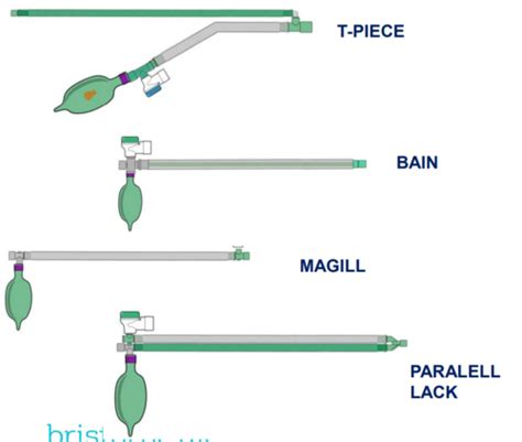 Cvsoh Calculations In Anaesthesia Flashcards Quizlet