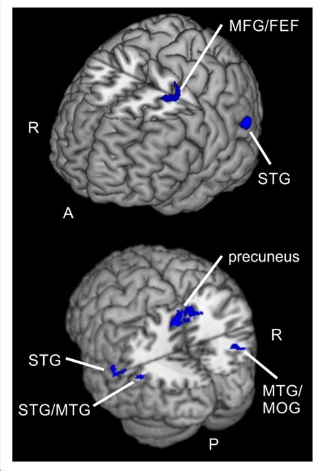 Spatial Compared To Feature Based Reorienting Overlay Of Activated Download Scientific