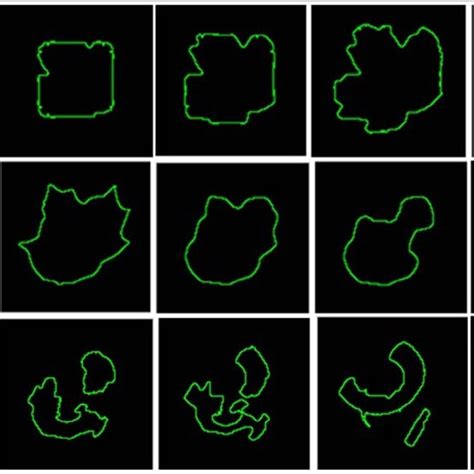 curve evolution under the proposed shape prior only download