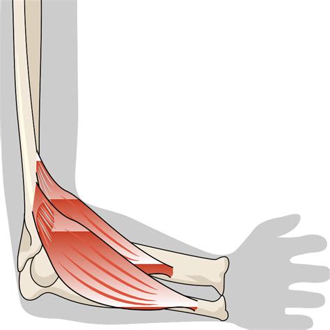 Tendonitis Arm Body Figure Science Figures