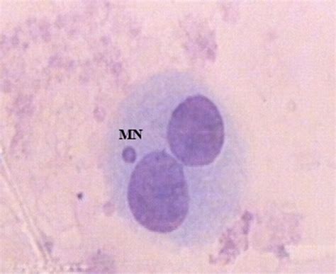 Represent Binucleated Lymphocyte With One Micronuclei Mn Download