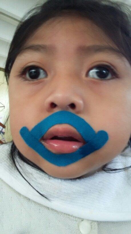 How Kinesiology Tape Is Being Used In Pediatric Care Artofit