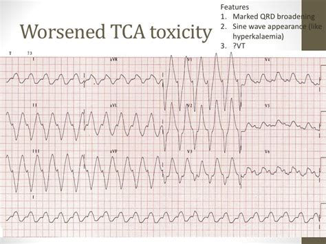 TCA Toxicity LearnED
