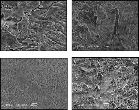 The Effect Of 20 Sec Etching On Enamel Of 4 Primary Molars As Observed Download Scientific