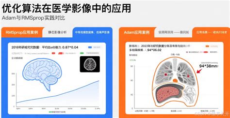 深度学习核心：优化算法adam、rmsprop 原理、实现及在医学影像领域的应用 Csdn博客