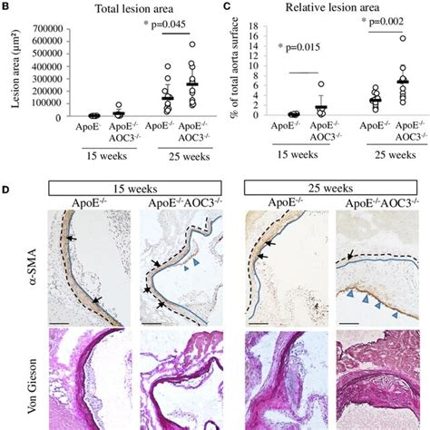 Lesion Surface In The Thoracic Aorta And α Sma In The Aortic Sinus The Download Scientific