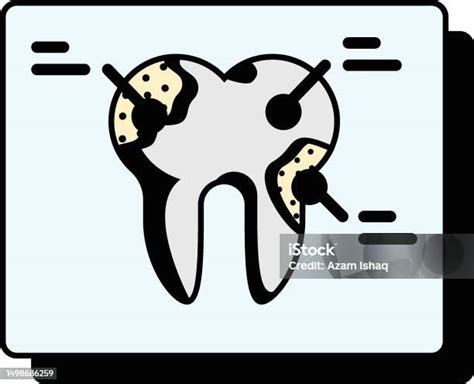 치열 교정 브래킷 배치 개념 디본딩 절차 벡터 아이콘 디자인 틀니 기호 구강 건강 관리 기호 치과 기구 스톡 일러스트레이션