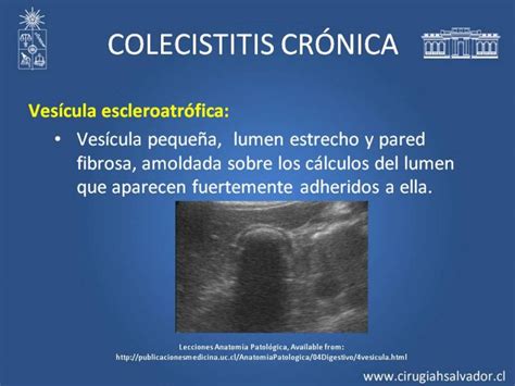 Presentaciones Depto Cirugía Hospital Del Salvador