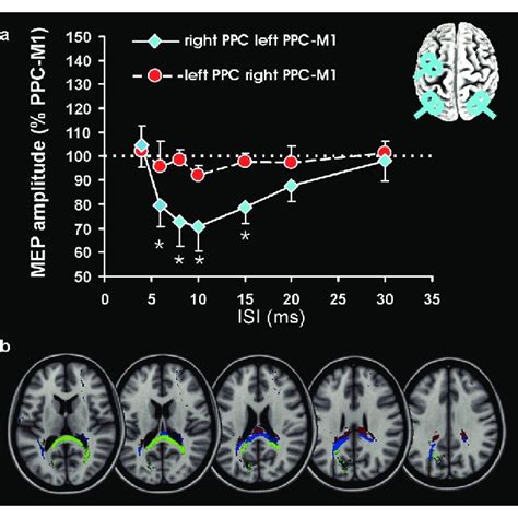 Effects Of Left And Right Posterior Parietal Cortex Ppc Transcranial