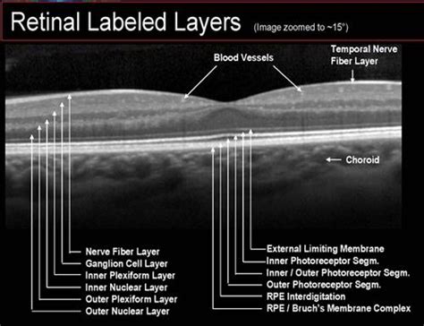 Predicting Visual Field Global And Local Parameters From Oct