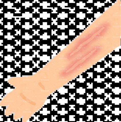 一只被划伤并且已经肿起伤痕贴纸扁平儿童插画元素卡通免扣png图片素材 花瓣网