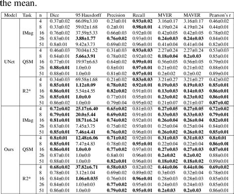 Fourier Disentangled Multimodal Prior Knowledge Fusion For Red Nucleus Segmentation In Brain Mri