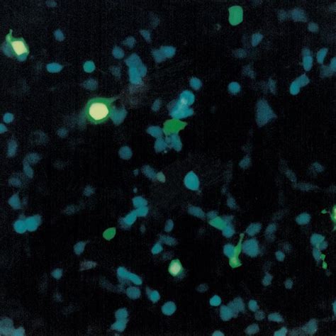 Pdf Recombinant Adeno Associated Virus Purification Using Novel Methods Improves Infectious