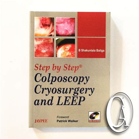 Colposcopy Cryosurgery And Leep Cuellar Ayala