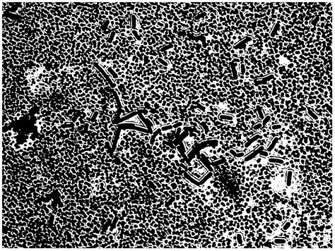 Bacillus Subtilis And Application Thereof Eureka Patsnap