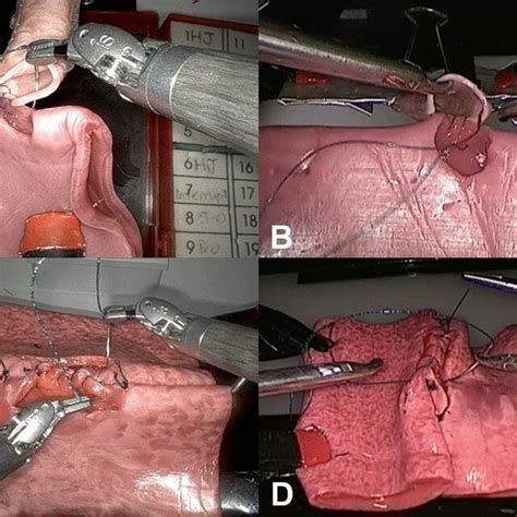Biotissue Models Of The A Robotic Hepaticojejunostomy B Robotic Download Scientific Diagram