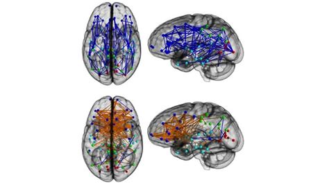 How Men S Brains Are Wired Differently Than Women S Fox News
