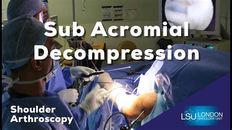 Shoulder Arthroscopy Subacromial Decompression By Consultant Rupen Dattani London Shoulder Unit