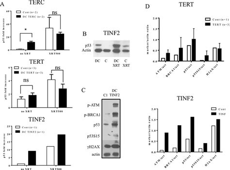 Basal And Radiation Induced Ddr Response In Dc Lymphocytes Control And
